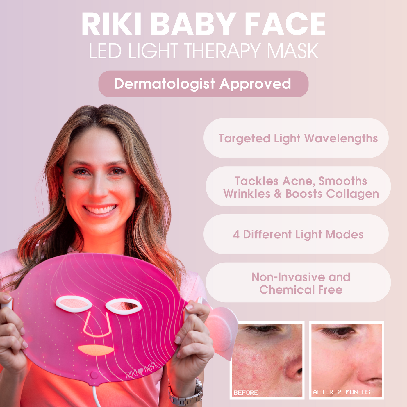 RIKI BABY FACE | Best LED skincare therapy mask for wrinkles & acne