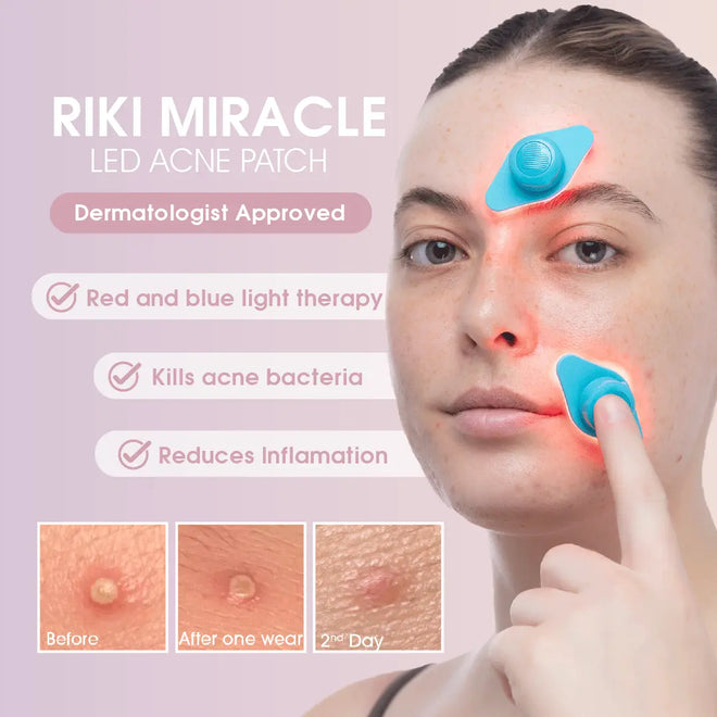 RIKI Miracle LED Acne Patch | Achieve Clear and Radiant Skin – RIKI ...